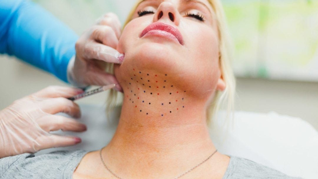 Kybella Treatment: Solution for Double Chin Reduction - Arizona MedLaser