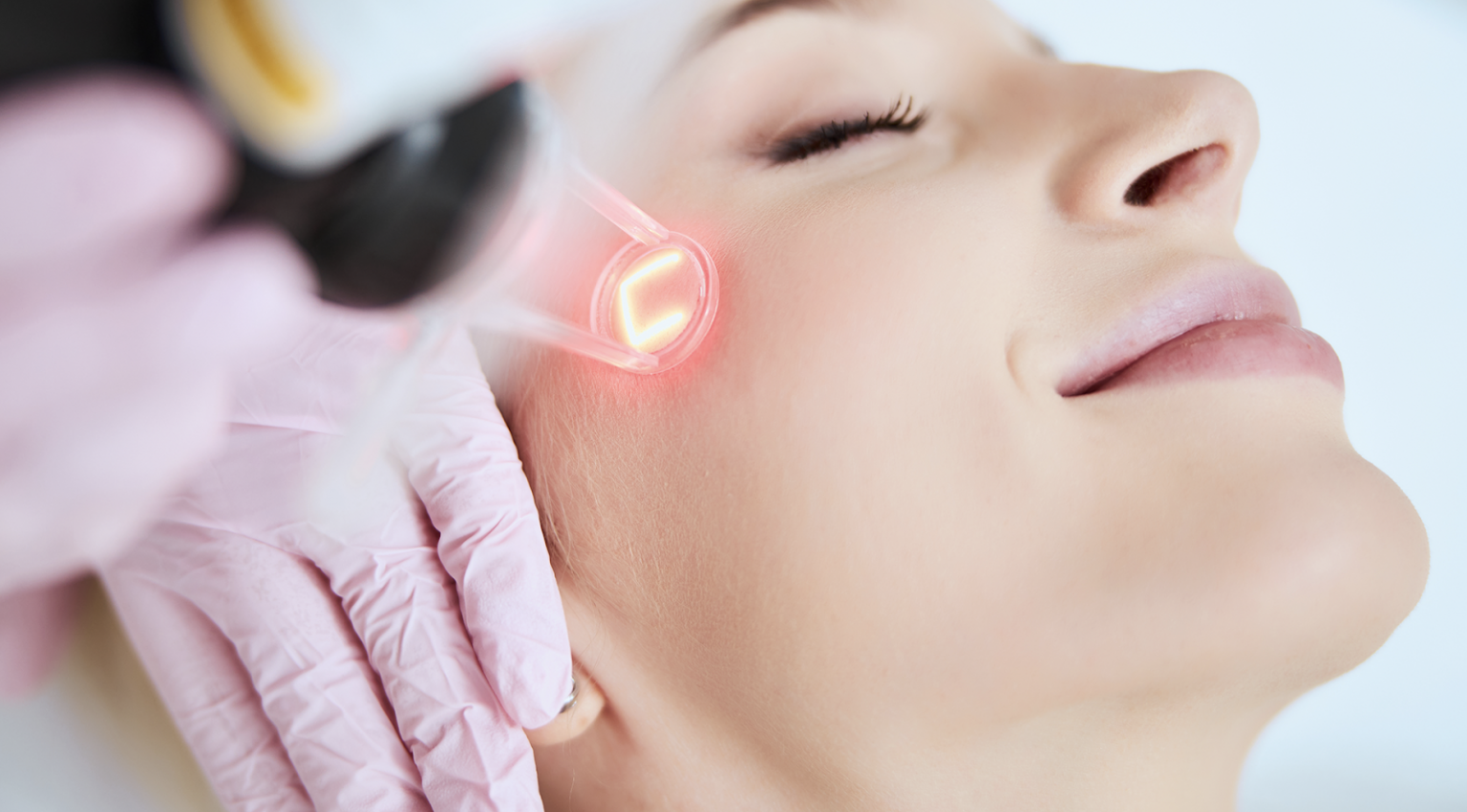 Laser Treatments for Pigmentation: What You Need to Know